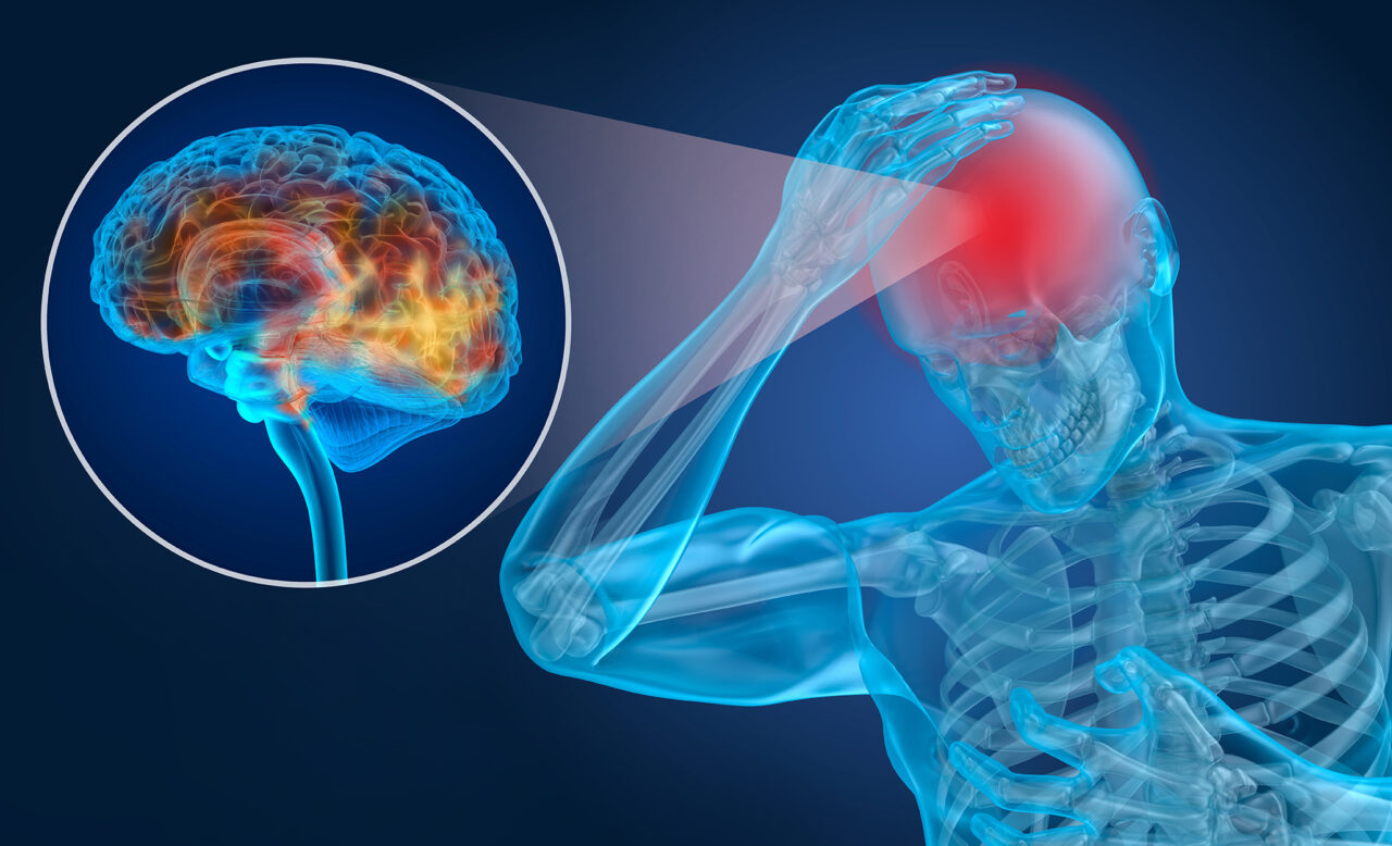 Why Test for Concussion | TBI Evidence